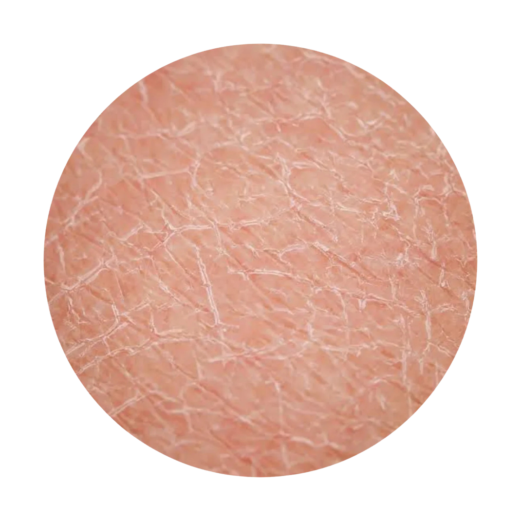 Rough & Blemished Skin